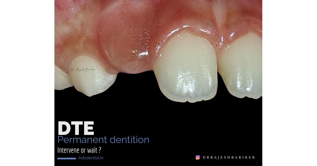 DTE (Delayed tooth emergence)
